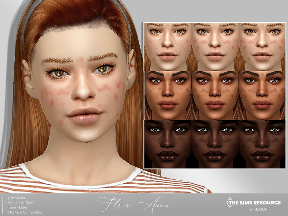 Flora Acne by MSQSIMS from TSR • Sims 4 Downloads